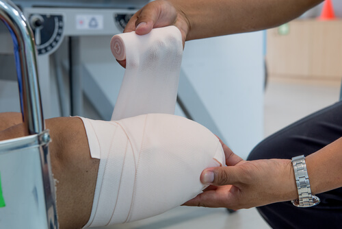 Workers' Compensation for Loss of Limb / Amputation in KY